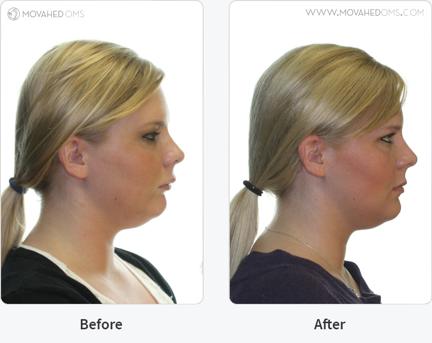 Case Study 2 – Movahed OMS