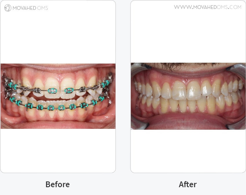 Case Study 4 – Movahed OMS