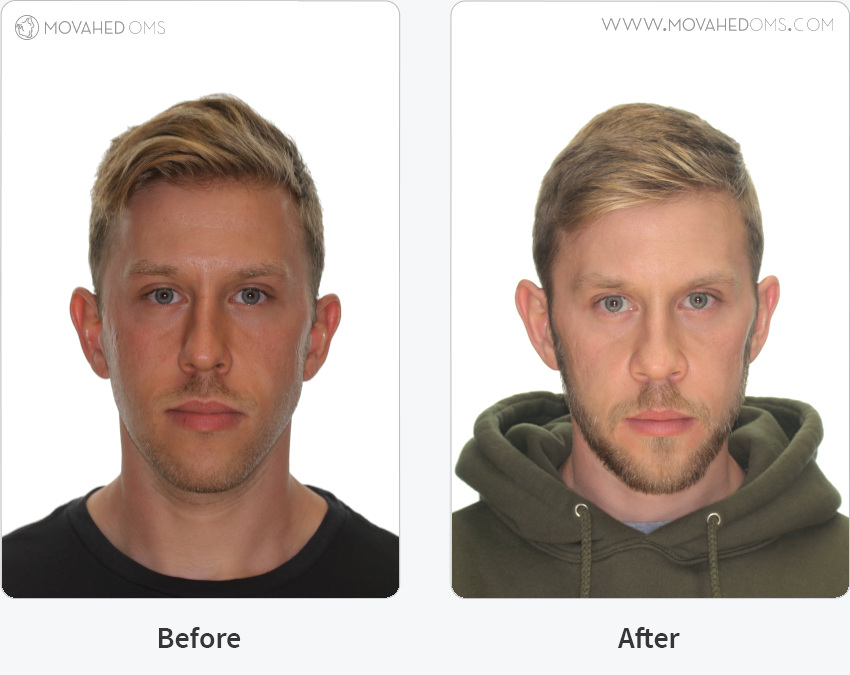 Case Study 2 – Movahed OMS