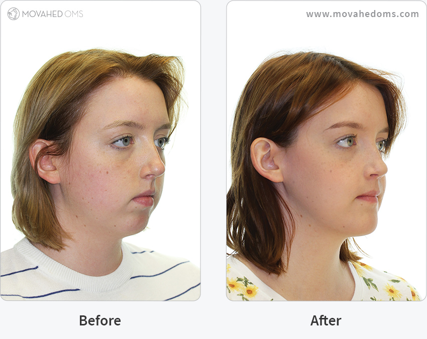 Case Study 1 – Movahed OMS