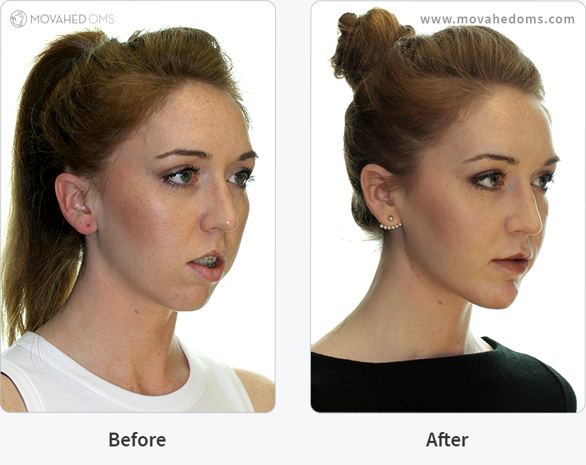 Case Study 3 – Movahed OMS