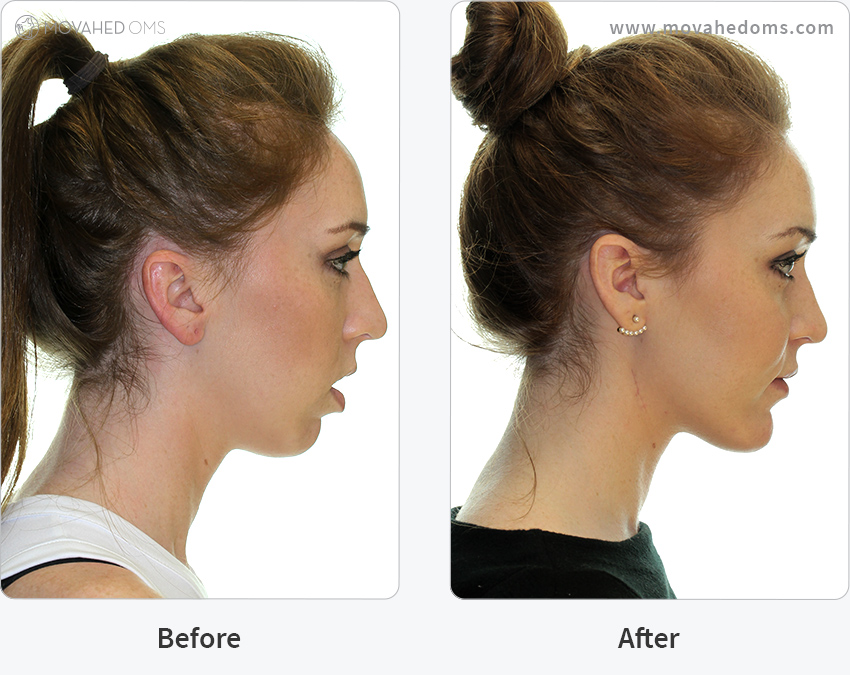 Case Study 3 – Movahed OMS