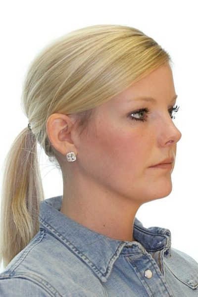 young-blonde-woman-after-temporomandibular-joint-tmj-surgery-semi-side ...